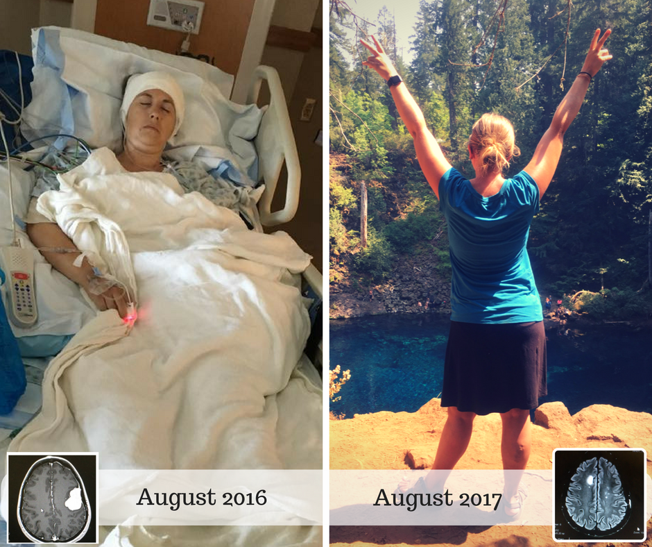 A Year In Review – Brain Surgery Update – BElieve Health & Fitness